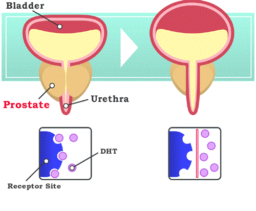 What is Nocturia? - Dr Anish Kumar Gupta